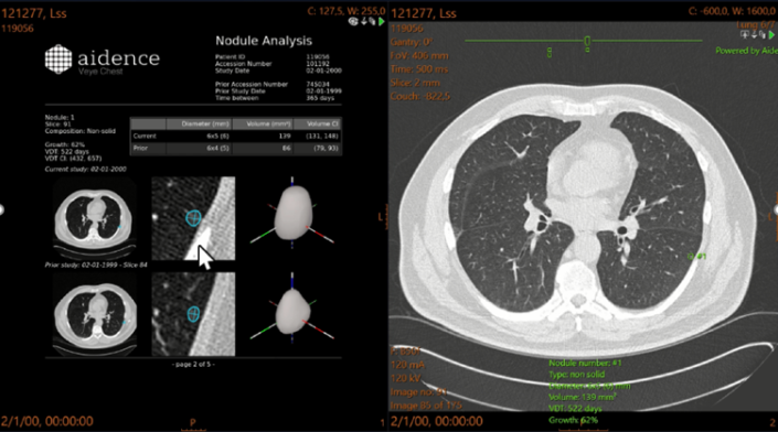 TMC secure even higher radiology quality with now 4 implemented AI ...